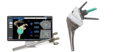 Stryker introduces Tornier Shoulder Arthroplasty Portfolio in India and launches Tornier Perform ...